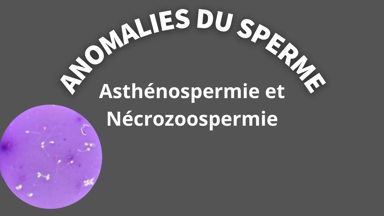 Nécrospermie : Définition, causes, symptômes et traitement naturel ...